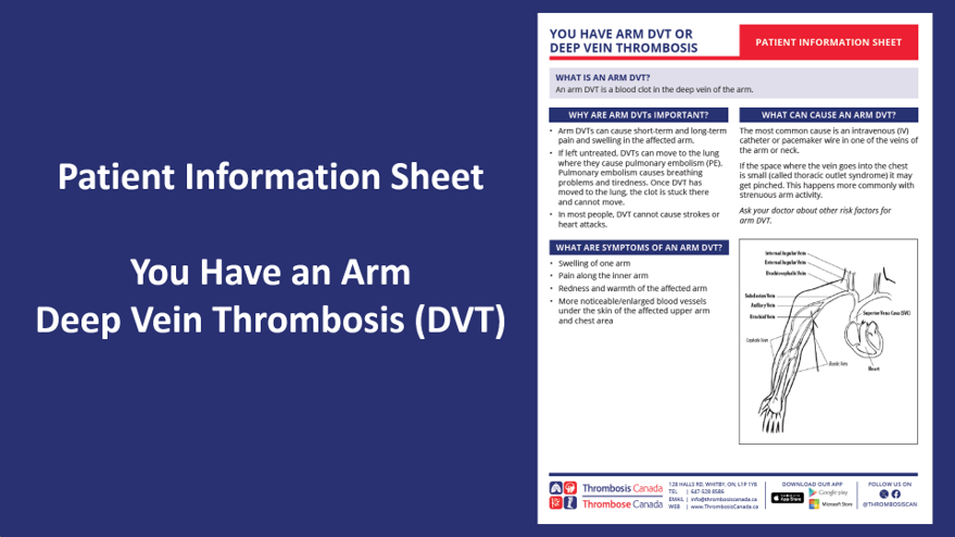 Thrombosis Canada